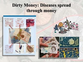 Dirty Money: Diseases spread through money (Currency notes) | PPTX