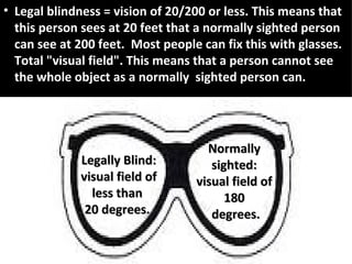 Disability blindness | PPT