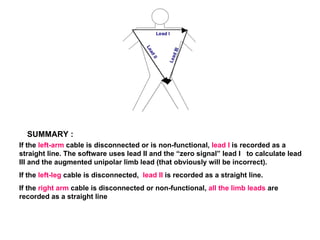 Disabled lead cables | PPT