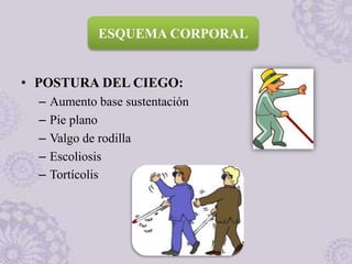 Discapacidad visual | PPTX