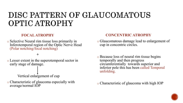 Disc Damage Likelihod Scale (DDLS) | PPTX