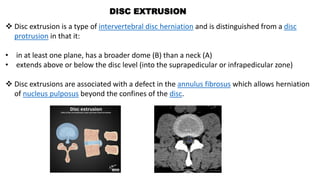 degenerative disease of sine | PPTX