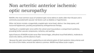 disc edema.pptx