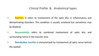 Disc edema ,papilloedema & optic neuritis | PPTX