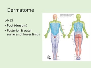 Disc herniation | PPT