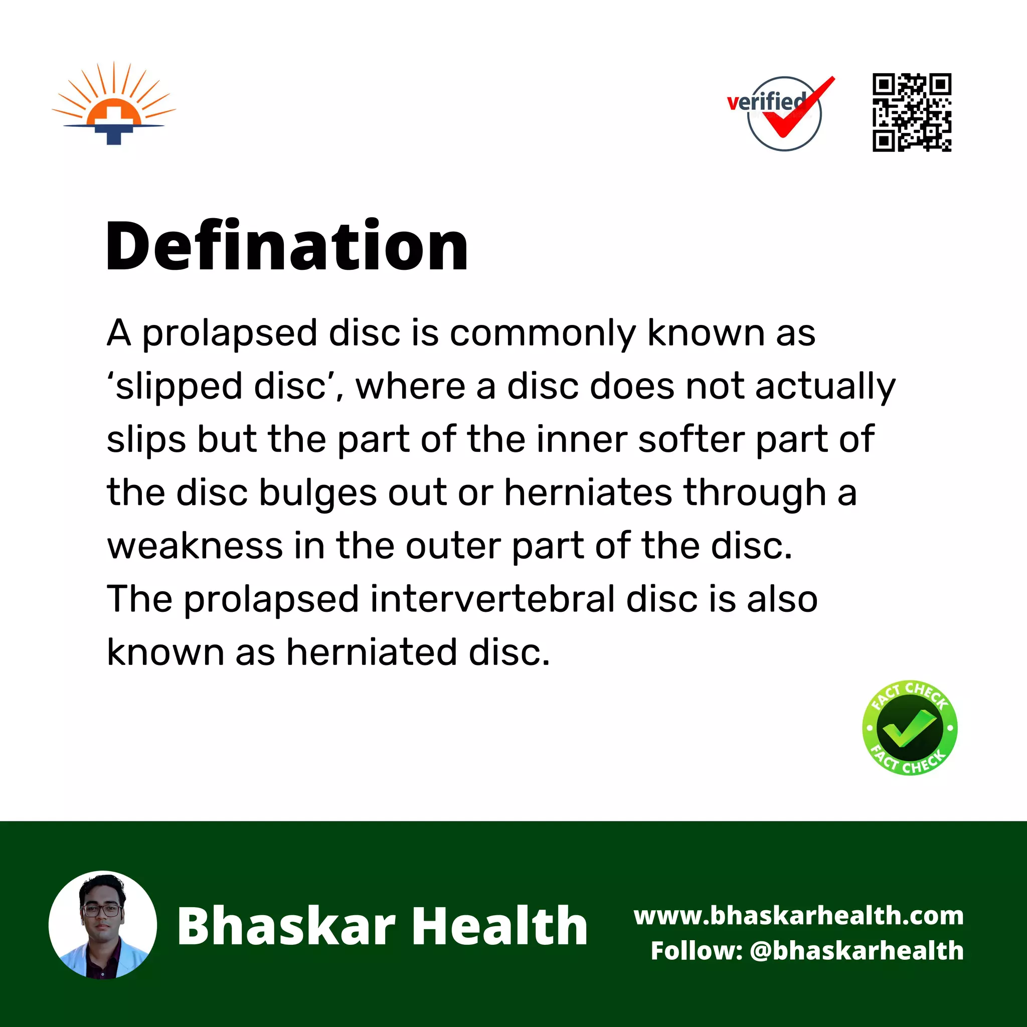 PIVD (Slipped or Herniated Disc): Physiotherapy Treatment | PDF
