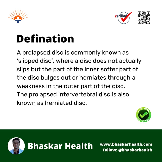 PIVD (Slipped or Herniated Disc): Physiotherapy Treatment | PDF