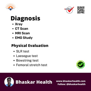 PIVD (Slipped or Herniated Disc): Physiotherapy Treatment | PDF