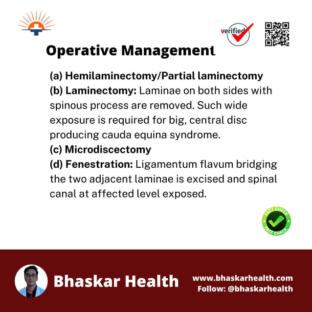 PIVD (Slipped or Herniated Disc): Physiotherapy Treatment | PDF