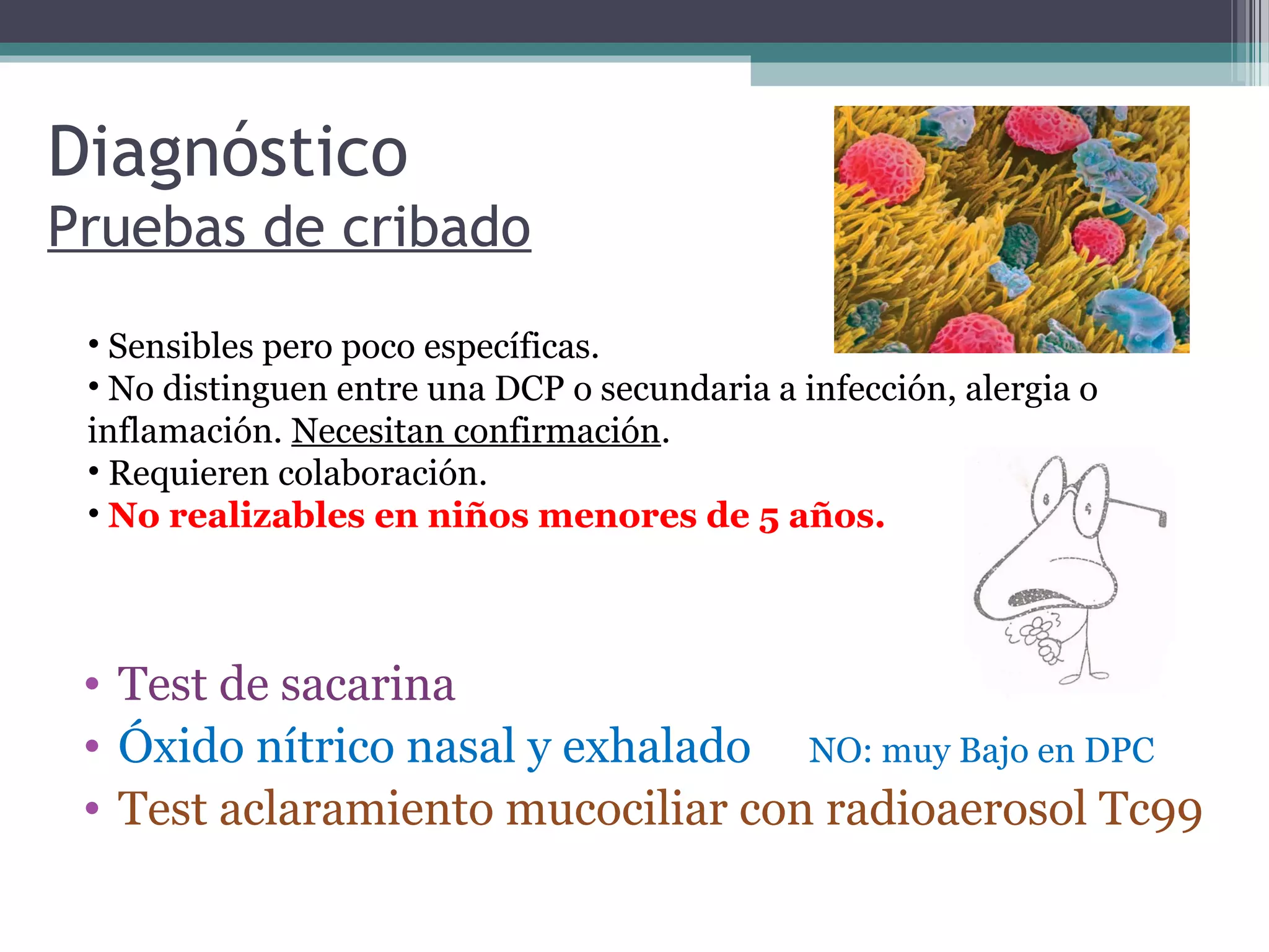 Discinesia ciliar primaria | PPT