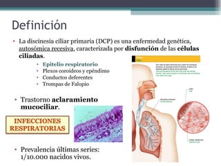 Discinesia ciliar primaria | PPT