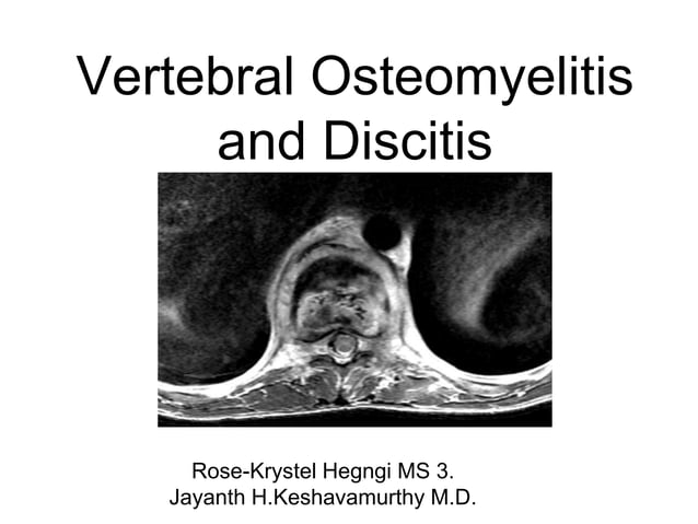 Discitis and osteomyelitis in Sickle cell disease | PPT