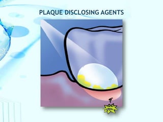 PLAQUE DISCLOSING AGENTS | PPTX