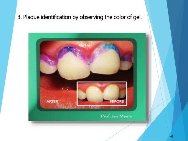 PLAQUE DISCLOSING AGENTS