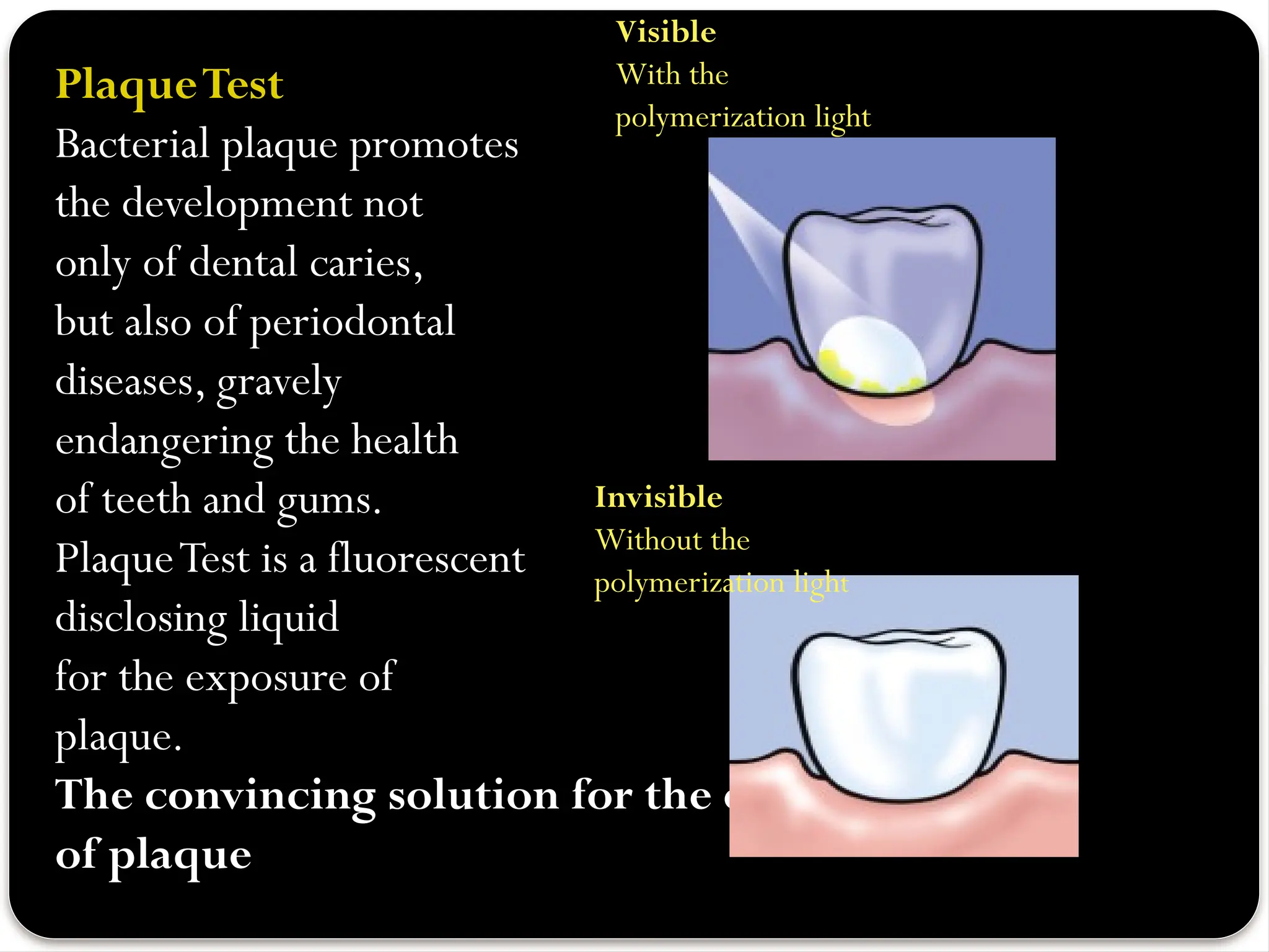 DISCLOSING AGENTS 2003.pptx in fdentistry | PPTX