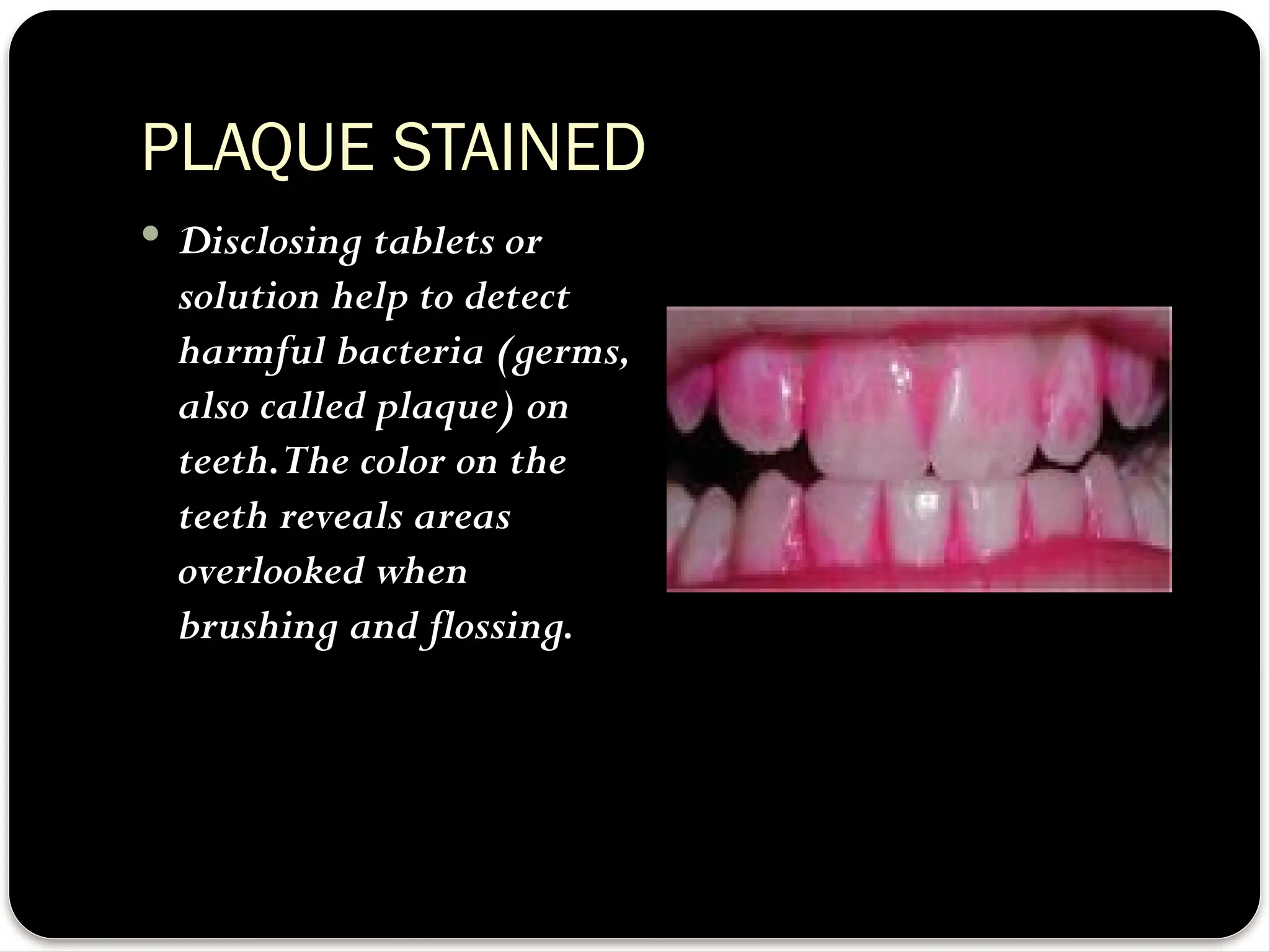 DISCLOSING AGENTS 2003.pptx in fdentistry | PPTX | Dental Health ...