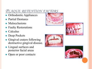 DISCLOSING AGENTS in dentistry ptx | PPTX