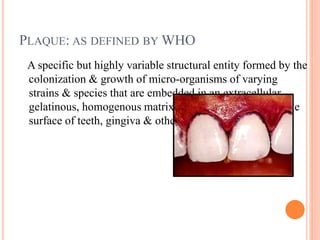 DISCLOSING AGENTS in dentistry ptx | PPTX