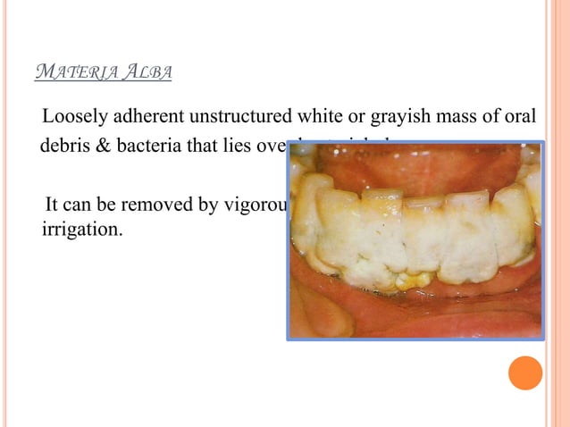 DISCLOSING AGENTS in dentistry ptx | PPTX | Oral care | Personal Care