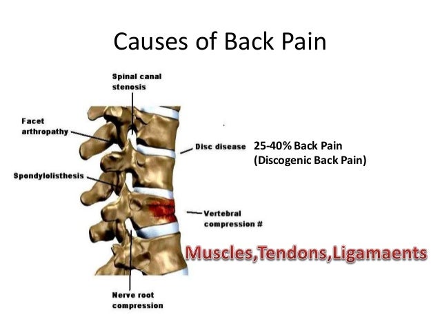 Discogenic back pain:Non-operative treatment by Dr Ashok Jadon,MD FIP…