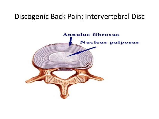 Discogenic back pain:Non-operative treatment by Dr Ashok Jadon,MD FIP…