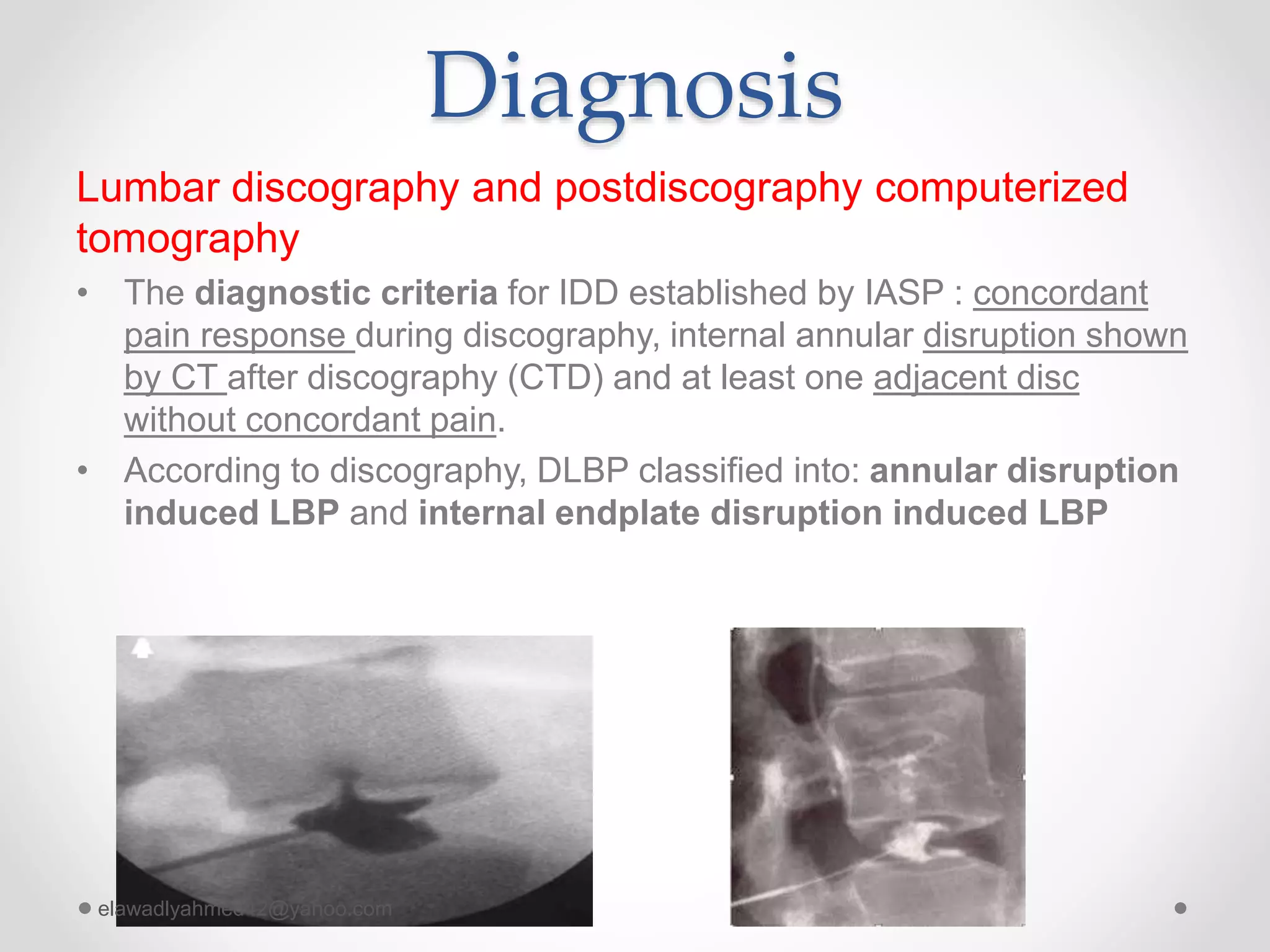 Discogenic low back pain | PPTX