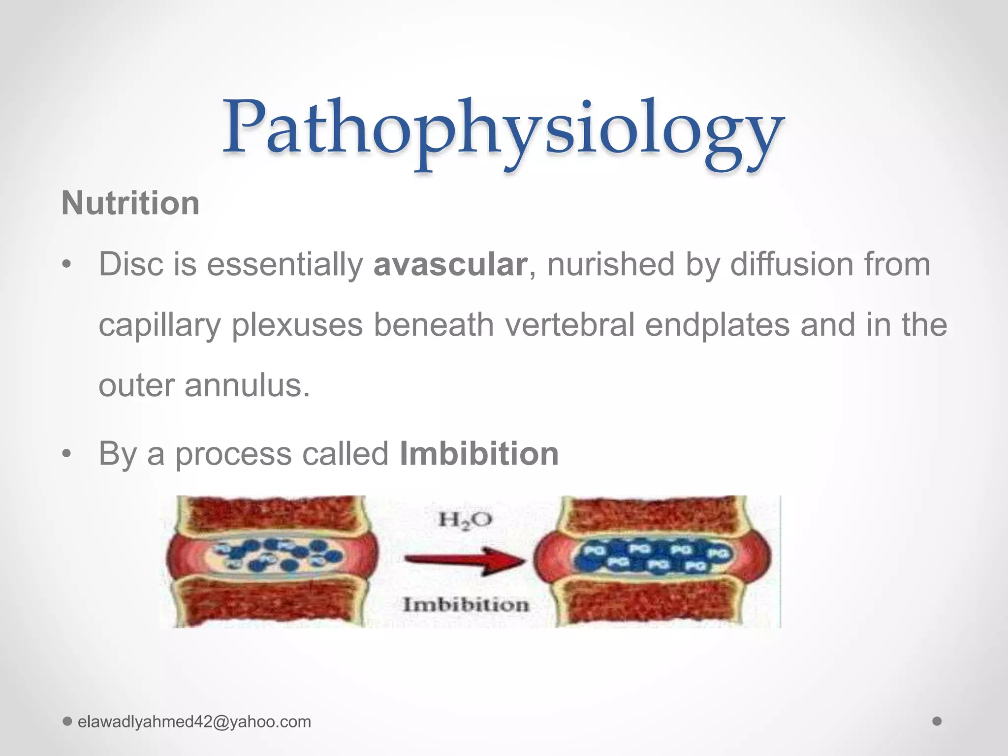 Discogenic low back pain | PPTX