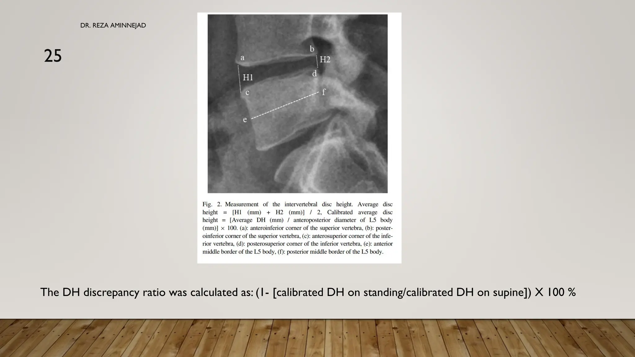 Diagnostic & Therapeutic Updates of Discogenic Low Back Pain | PDF