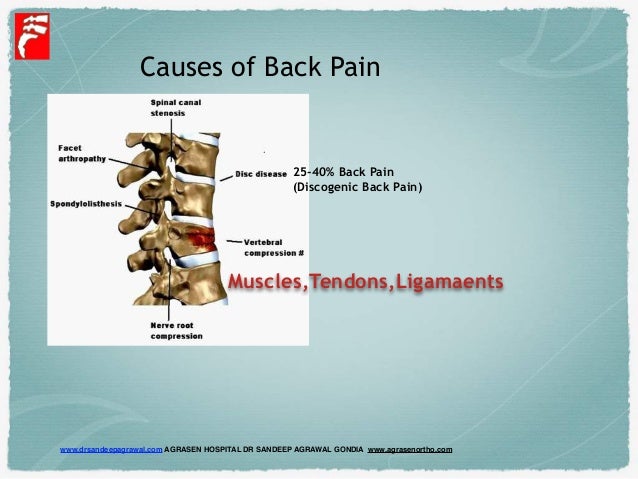 Discogenic low back pain Treatment agrasen hospital gondia vidarbha d…