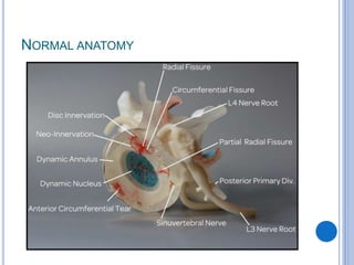 Discograpgy (intradiscal procedure) | PPTX