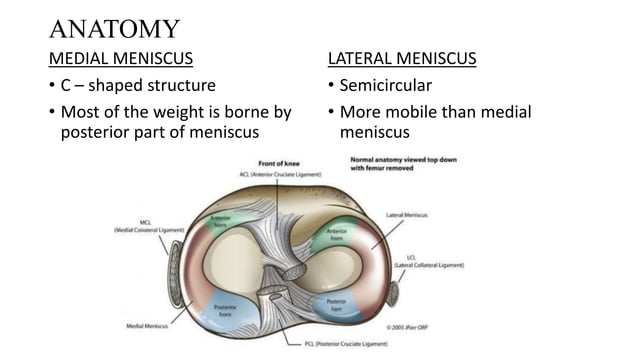 Discoid meniscus | PPTX | Death, Injury, or Military Conflict ...