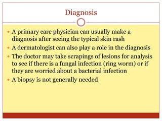 Discoid eczema | PPT