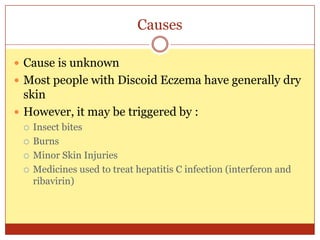 Discoid eczema | PPT