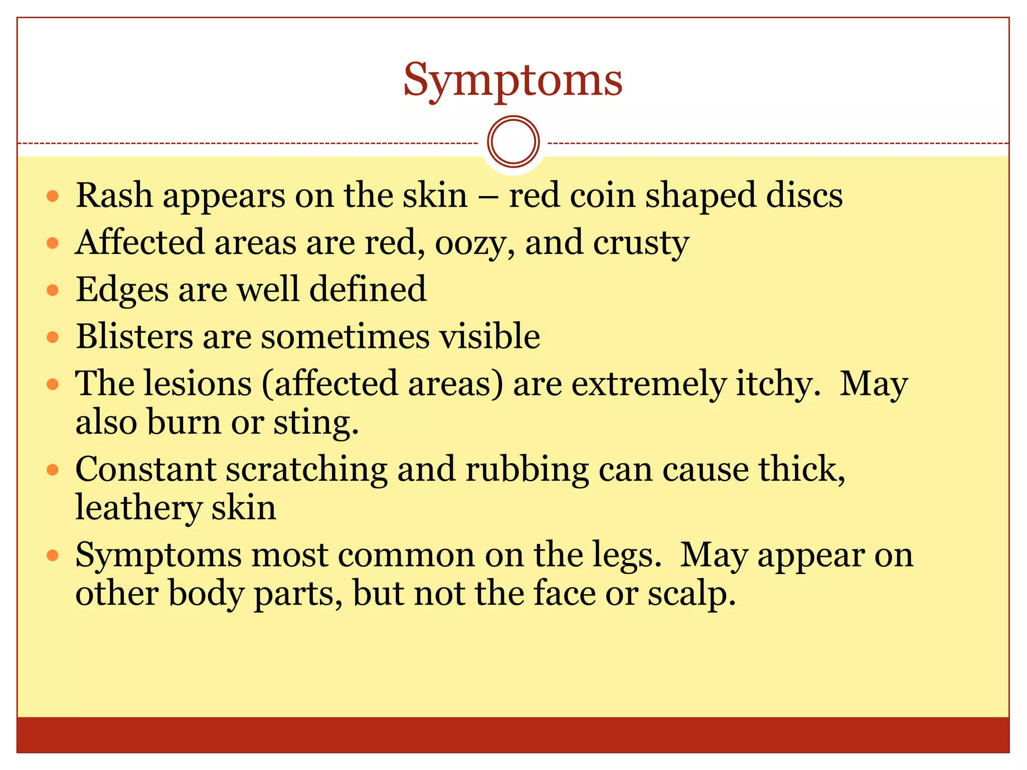 Discoid eczema | PPTX