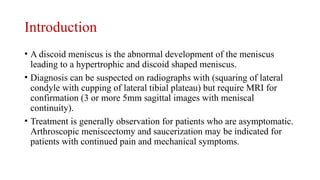 discoid menisci.pptx presentation doccum | PPTX