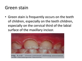 Discoloration of teeth | PPTX
