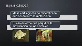 Discondrosplasia tibial | PPTX