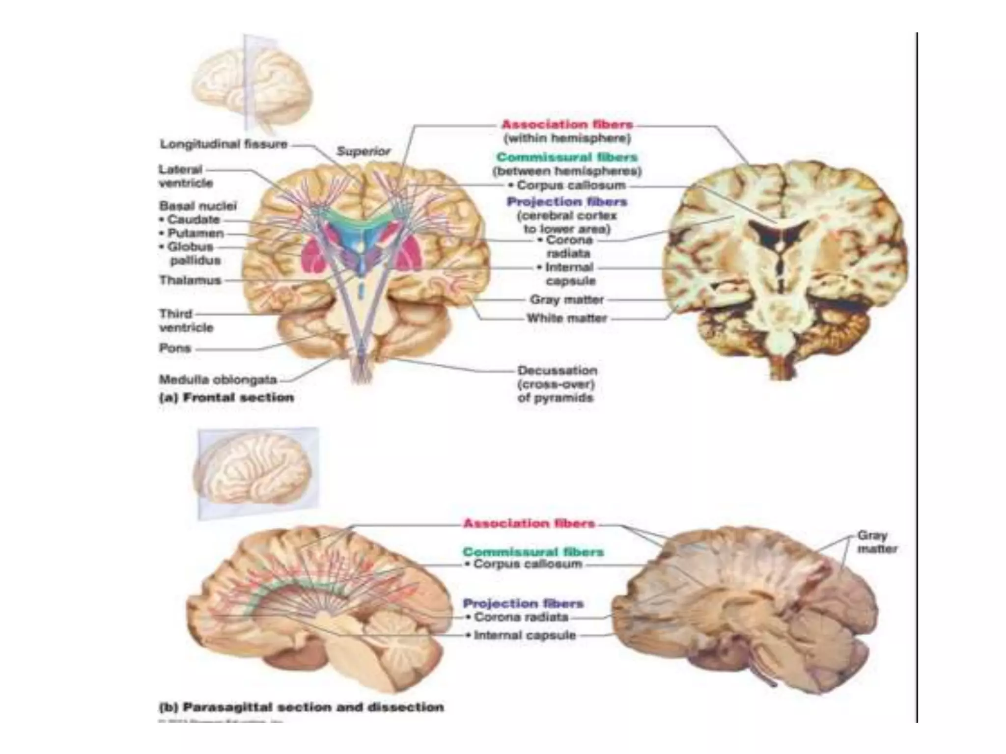 Disconnection syndrome | PPTX