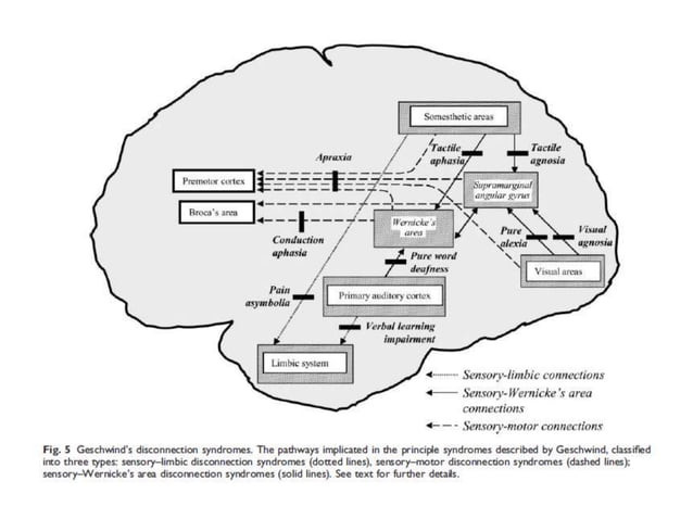 Disconnection syndrome | PPTX