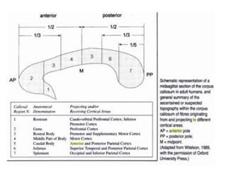 Disconnection syndrome | PPTX