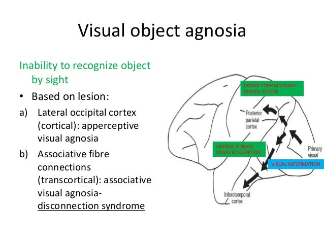 👍 Types of visual agnosia. Visual Agnosia. 2019-01-17