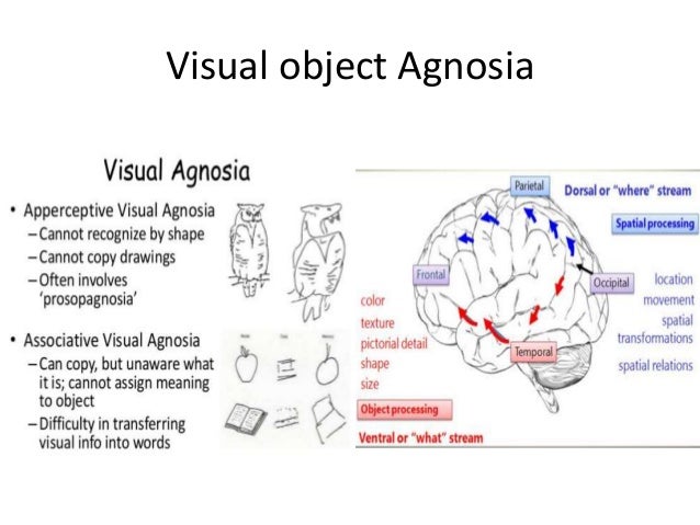 Disconnection syndrome