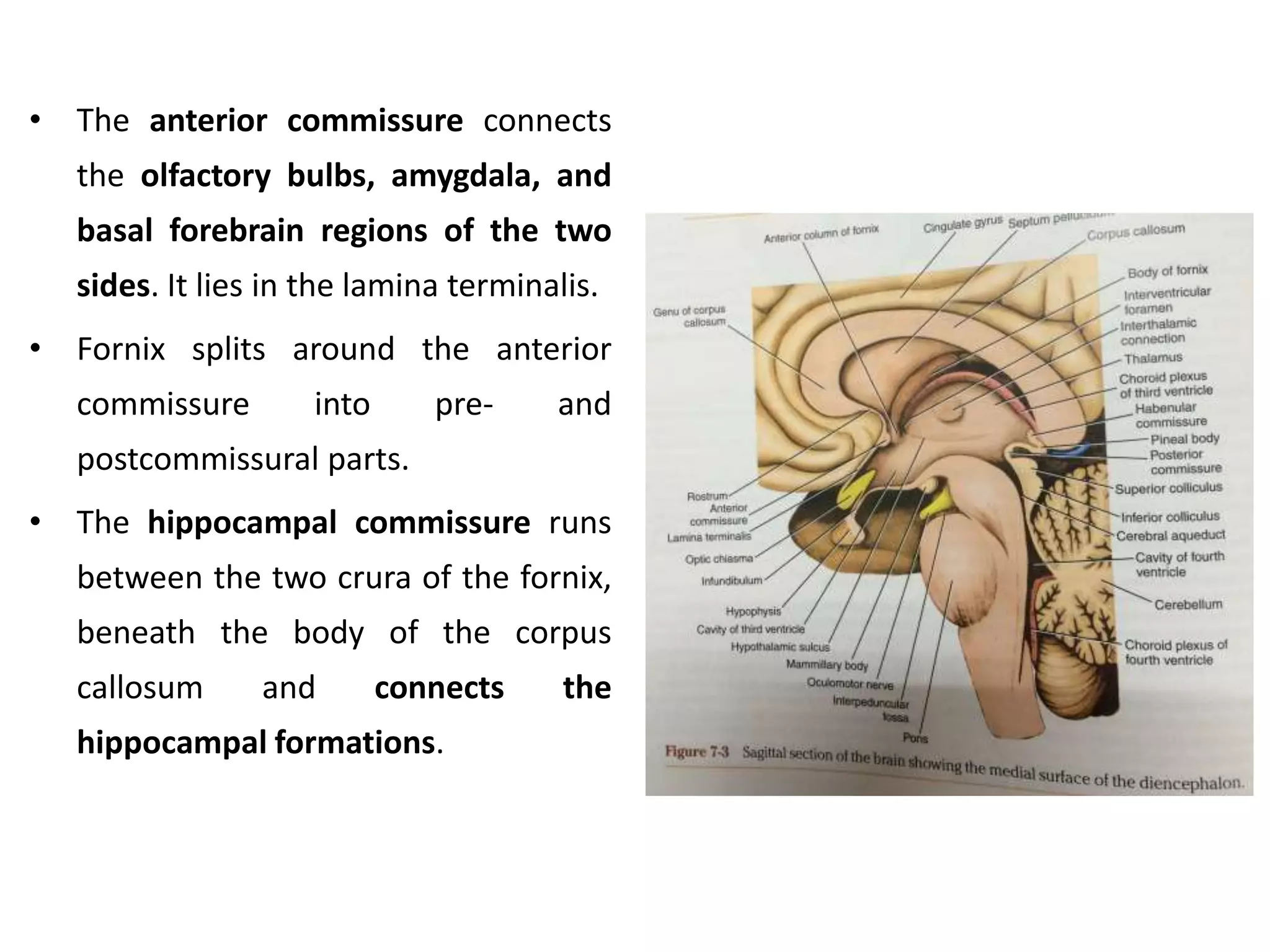 Disconnection syndromes sharath | PPTX