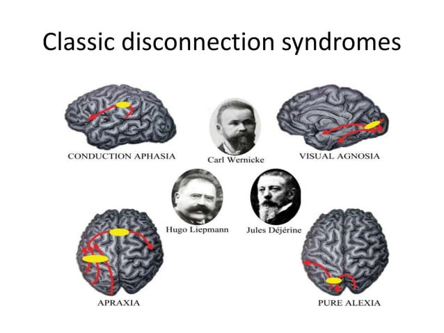 Disconnection syndromes sharath | PPTX