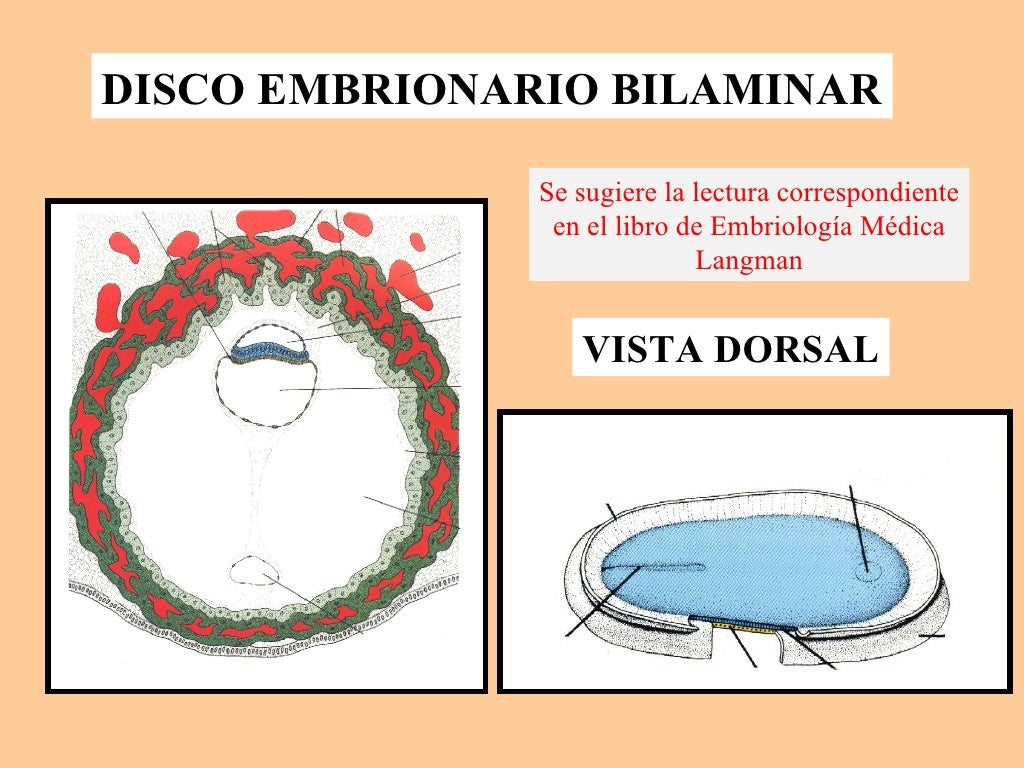 Disco Trilaminar