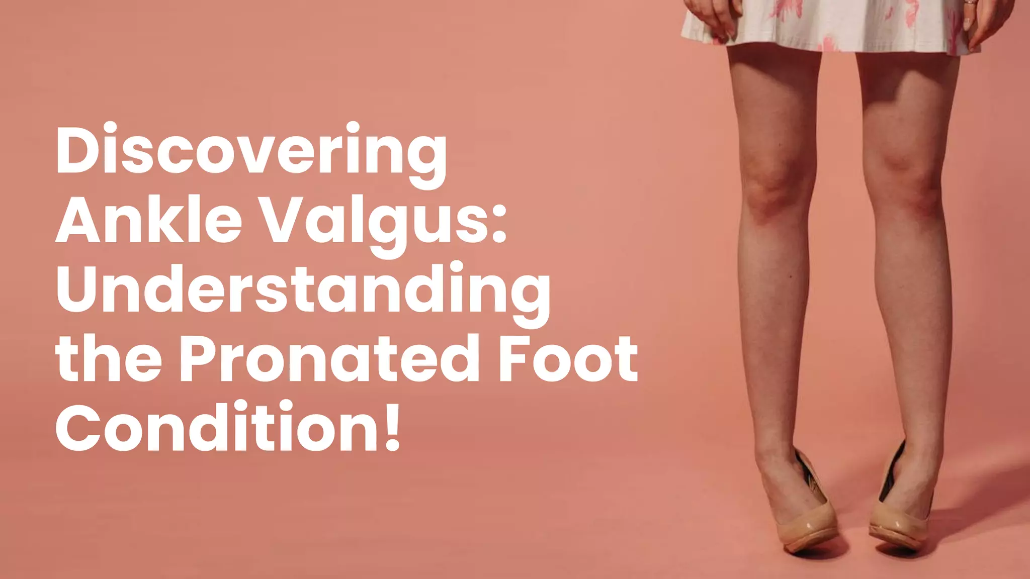 Discovering Ankle Valgus Understanding the Pronated Foot Condition | PDF