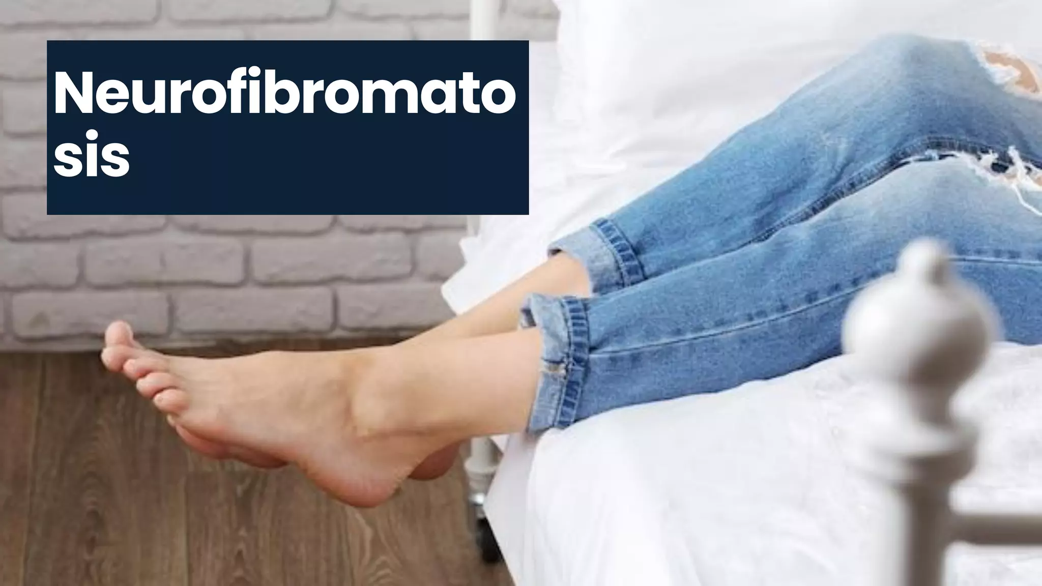 Discovering Ankle Valgus Understanding the Pronated Foot Condition | PDF