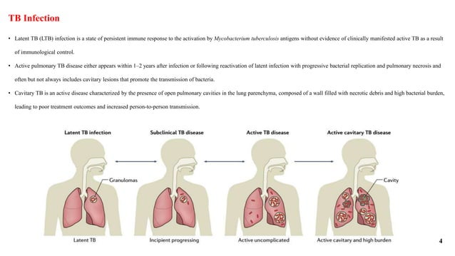 Discovery and Mechanistic Study of Mycobacterium tuberculosis PafA Inhibitors.pptx