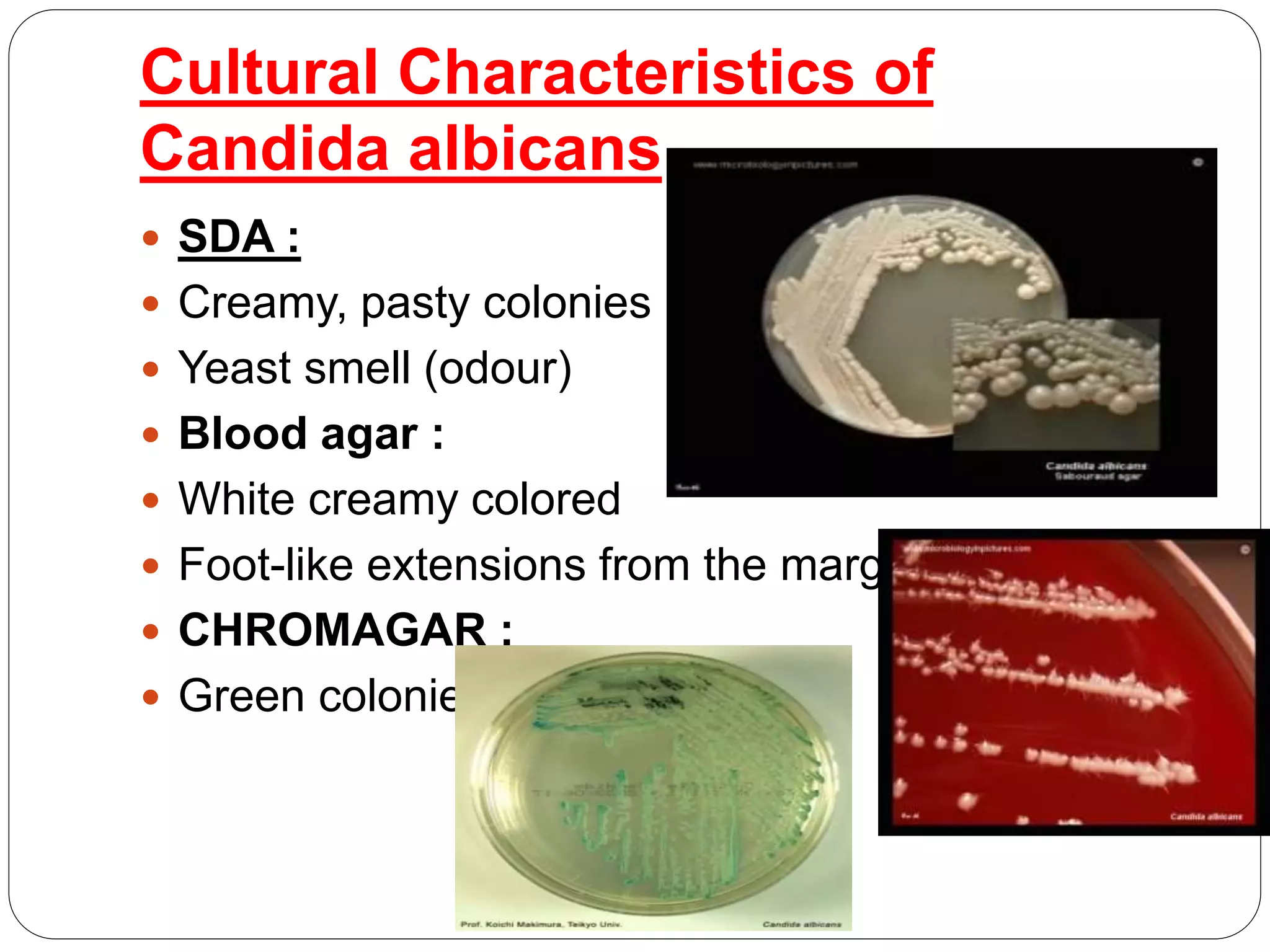 Discovery of candida | PPTX