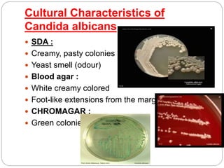 Discovery of candida | PPTX